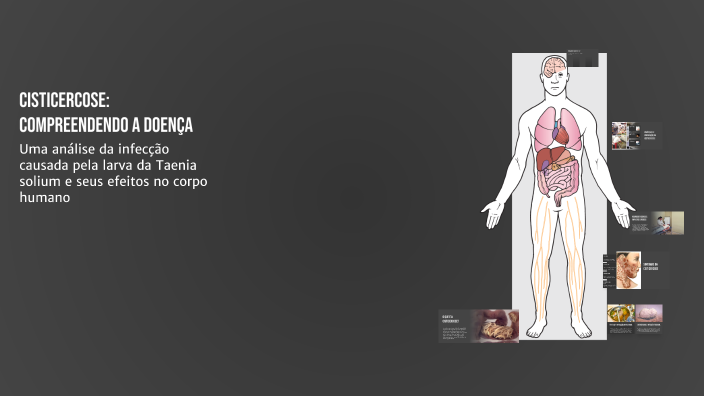 Cisticercose: Compreendendo a Doença by Belle Marianne Nascimento ...