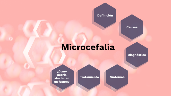 Microcefalia by Paula on Prezi