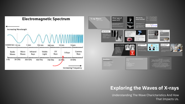 X-rays by Austin Cellio on Prezi