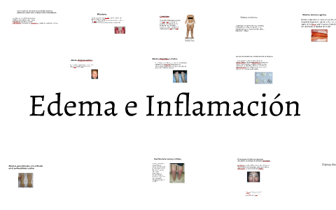 Edema e Inflamación by Danny Bonilla on Prezi