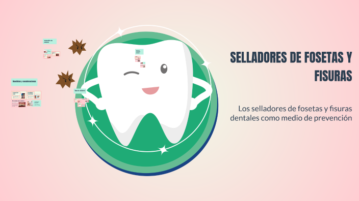 SELLADORES DE FOSETAS Y FISURAS by Anel Karely Olivas Velazquez on Prezi