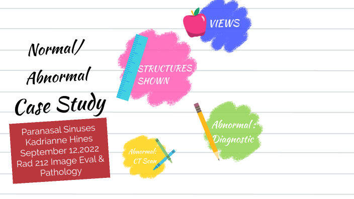 Normal Abnormal Sinuses By Kadrianne Hines On Prezi