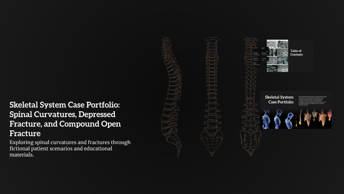 Skeletal System Case Portfolio: Spinal Curvatures, Depressed Fracture ...