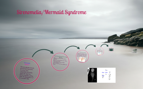 Mermaid Syndrome by jaimie randall on Prezi