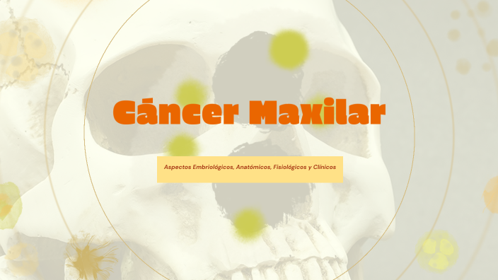 Cáncer Maxilar by Adriana Isabel Sánchez López on Prezi