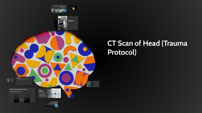 CT Scan of Head (Trauma Protocol) by Abdulrahman Alghamdi on Prezi