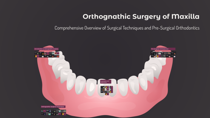 Orthognathic Surgery of Maxilla by umang on Prezi