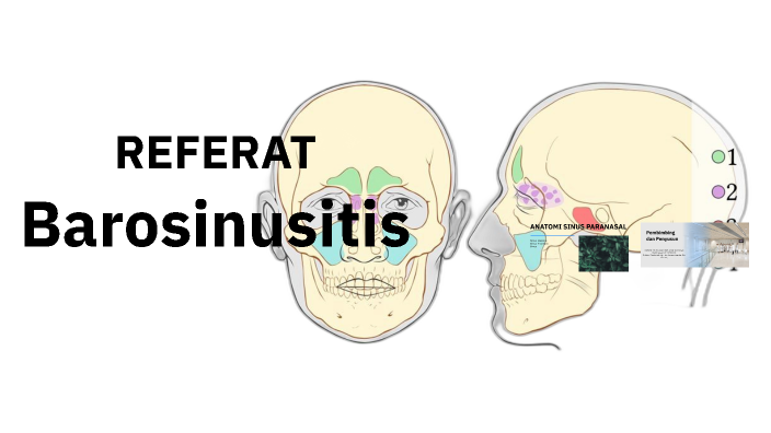 Barosinusitis by Lana Winters on Prezi