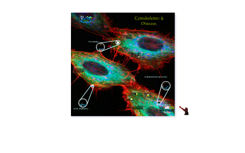 Cytoskeleton & Disease - Presentation by The Cytoskeleton on Prezi