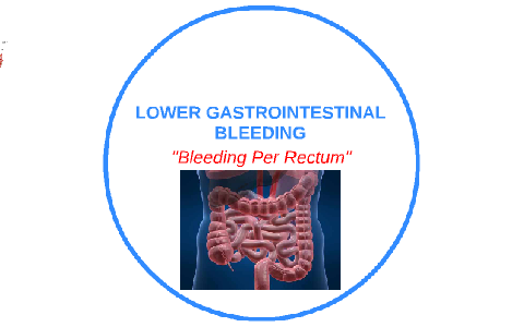 Lower GastroIntestinal Bleeding by ayat elsherif on Prezi