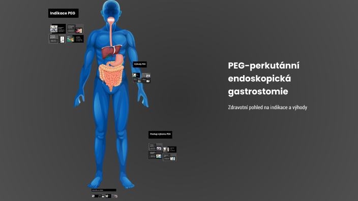 PEG-perkutánní endoskopická gastrostomie by adela zackova on Prezi