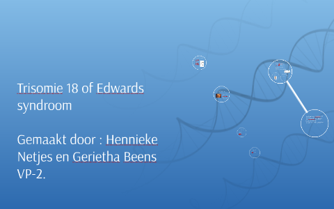 Trisomie 18 of Edwards syndroom by on Prezi