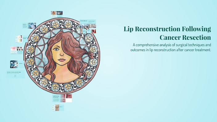 Lip Reconstruction Following Cancer Resection by שני גילרון on Prezi