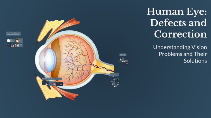 Human Eye: Defects and Correction by Platosplanet2024 on Prezi