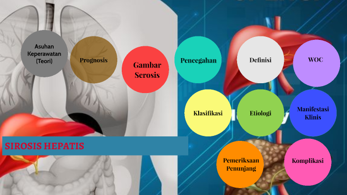 SIROSIS HEPATIS by 1130018004 NUR HAMIDAH MAGHFIRO on Prezi