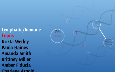 Lupus Powerpoint by Charlene Arnold on Prezi