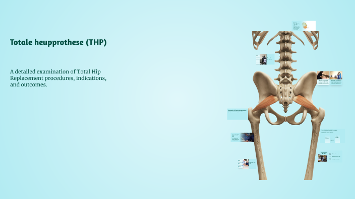 Total Hip Replacement (THR): A Comprehensive Overview by Linda ...
