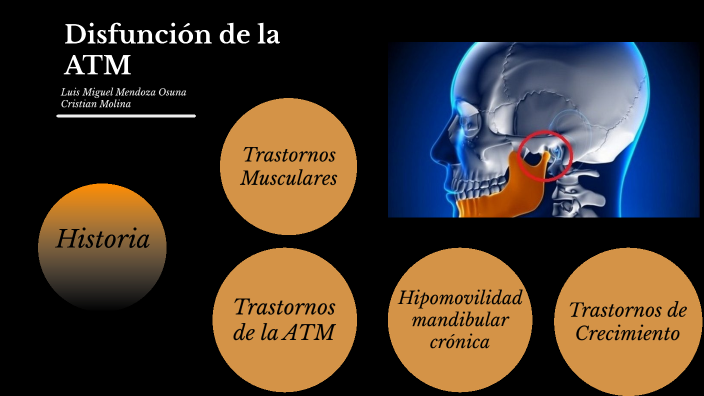 DISFUNCION DE LA ATM Y SU TRATAMIENTO by Luis Mendoza on Prezi