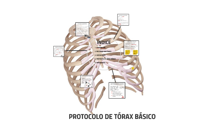 PROTOCOLO DE TÓRAX BÁSICO by María López Garrido on Prezi