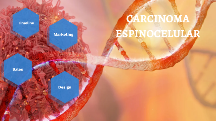 Carcinoma Espinocelular by joshua Sarmiento on Prezi