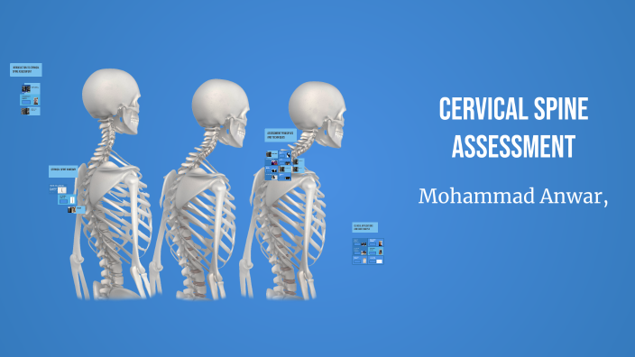 Cervical Spine Assessment by on Prezi