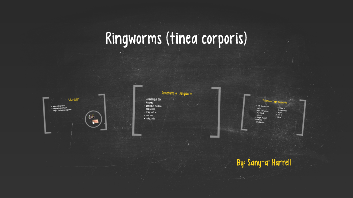 Ringworm (tinea cor by Sanya H on Prezi