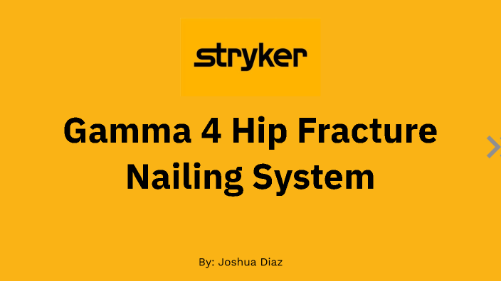 Gamma 4 Hip Fracture Nailing System by Josh Diaz on Prezi