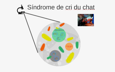 Síndrome de cri du chat by on Prezi