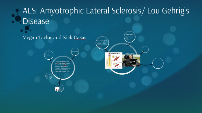 ALS: Amyotrophic Lateral Sclerosis/ Lou Gehrig's Disease by on Prezi