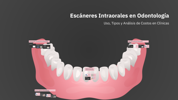 Escáneres Intraorales en Odontología by Ines Bula Muatariobo on Prezi