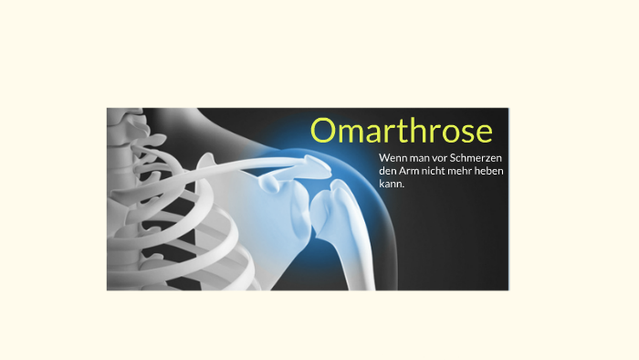 Omarthrose by Baum Albi on Prezi
