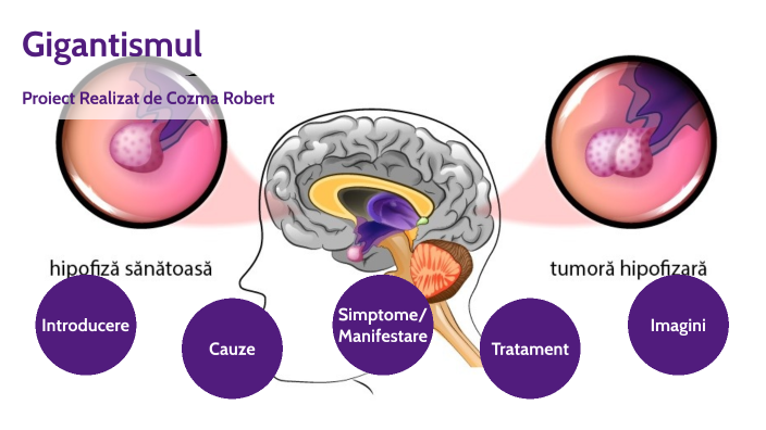 Proiect Boli Endocrine - Cozma Robert by Robert Cozma on Prezi
