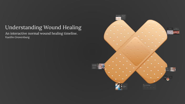 Understanding the Wound Healing Timeline by Kaetlin Grovenburg on Prezi