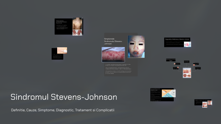 Sindromul Stevens-Johnson: Ghid Complet by Bîclea Cristian on Prezi