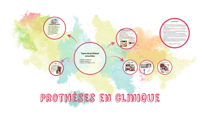 Prothèses amovibles by Anna Maria Turcanu on Prezi