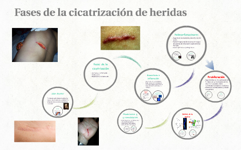 Fases de la cicatrizacion de heridas by Carlos Ernesto VC on Prezi