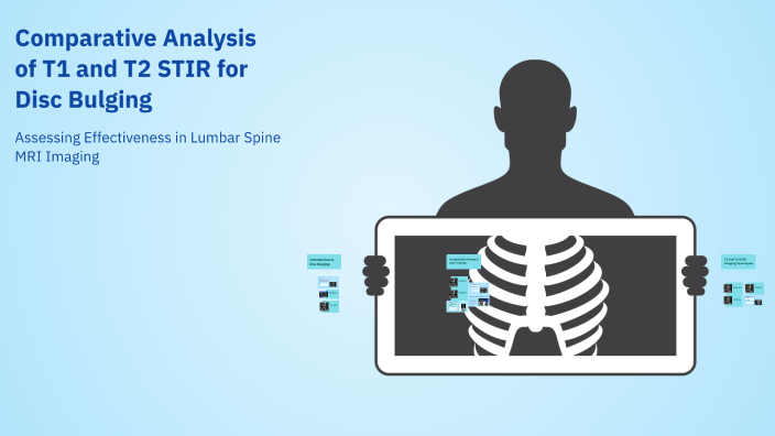 Comparative Analysis of T1 and T2 STIR for Disc Bulging by Qais Jamal ...