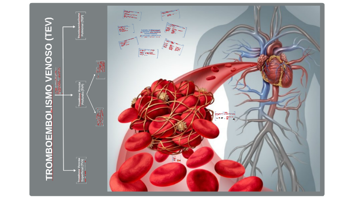 Tromboembolismo Venoso by Guido Sani Avanza on Prezi