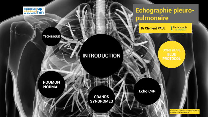 Echographie pleuro-pulmonaire by Clément Paul on Prezi