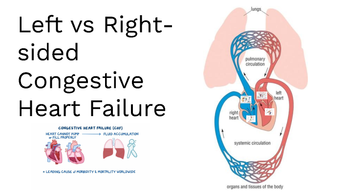 Left vs Right-sided Congestive Heart Failure by Nicole Choy on Prezi