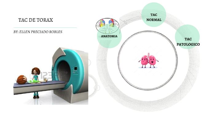 TAC DE TORAX NORMAL Y PATOLOGICO/ELLEN PRECIADO by ellen preciado on Prezi