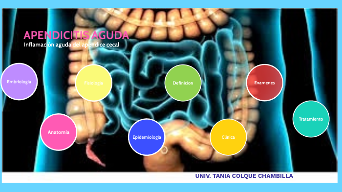 apendicitis by Tania Colque Chambilla on Prezi