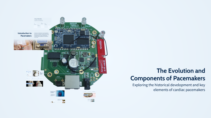 The Evolution and Components of Pacemakers by Valentina Villarroel ...