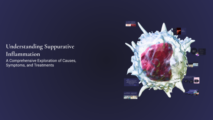 Understanding Suppurative Inflammation by mostafa 3bbud on Prezi
