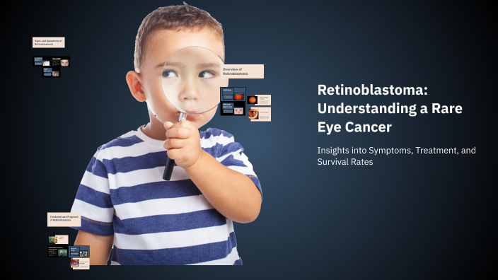 Retinoblastoma: Understanding a Rare Eye Cancer by Jonathan Franco ...