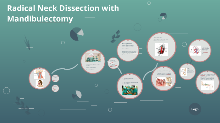 Radical Neck Dissection with Mandibulectomy by patsy orellana on Prezi