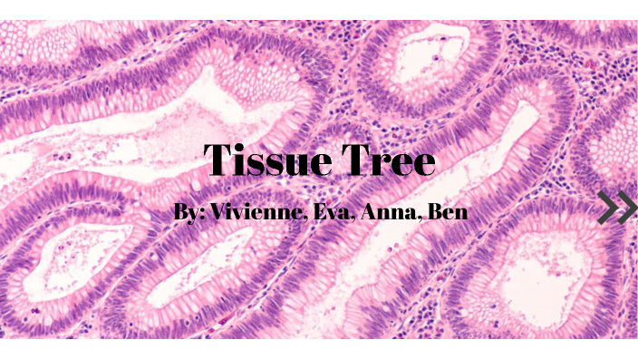 Tissue Tree Flowchart by Vivienne Phillips on Prezi