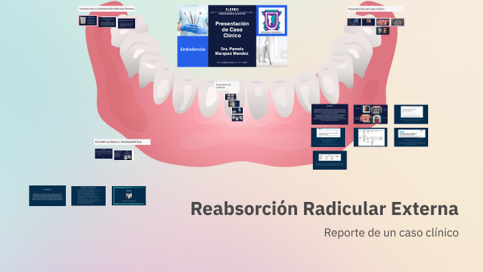 Reabsorción Radicular Externa by DIANA MAYELA ANGULO on Prezi