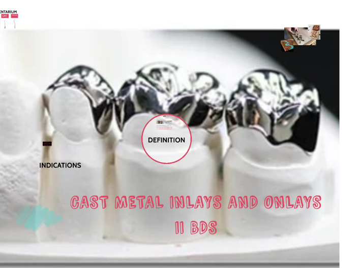 Cast Metal Inlays and Onlays by yohan chacko on Prezi