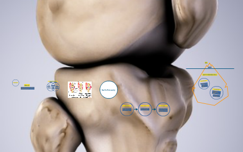 Rheumatoid Arthritis by Sarah Gillmore on Prezi